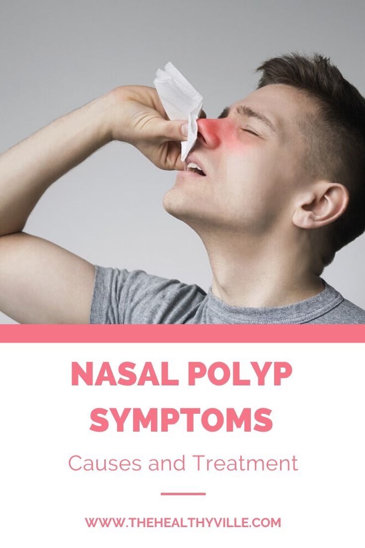 Nasal Cancer Symptoms Mayo Clinic